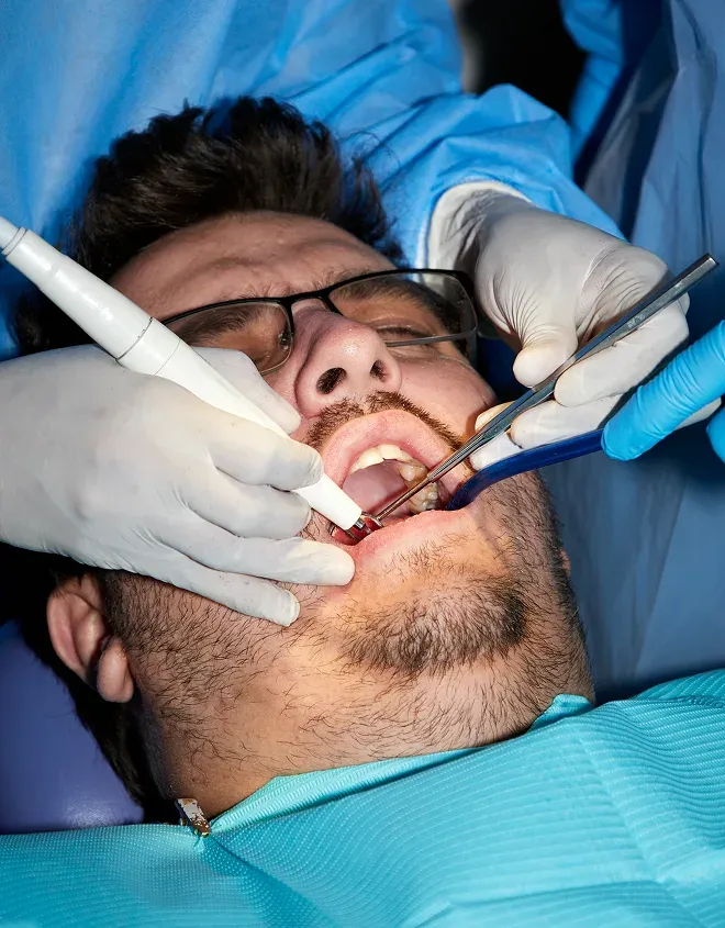 Root Canal in Union City: Step-by-Step Treatment Guide